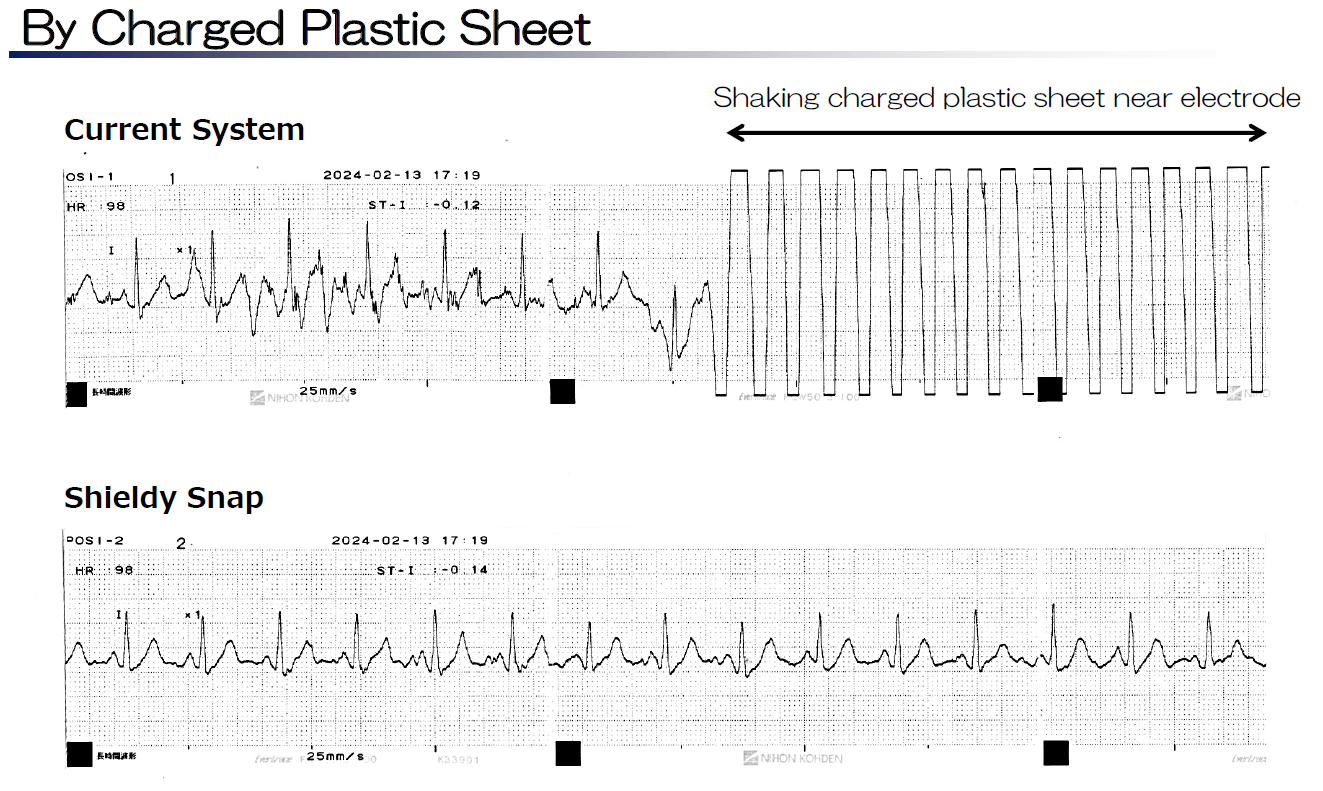 Ecg Noise Reduction Health Science Technologies