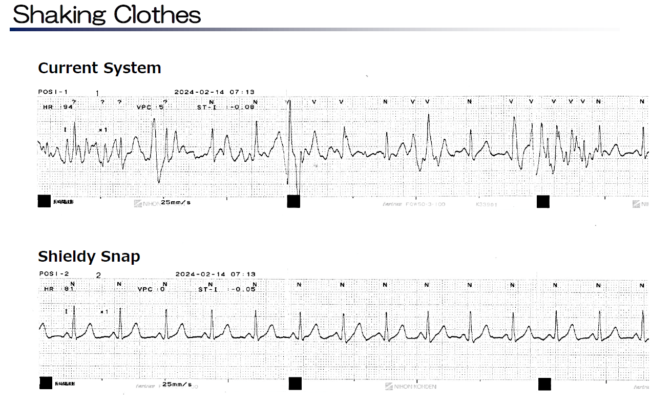 Ecg Noise Reduction Health Science Technologies